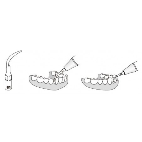 Insert Dentaire G1 compatible EMS - Insert Dentaire